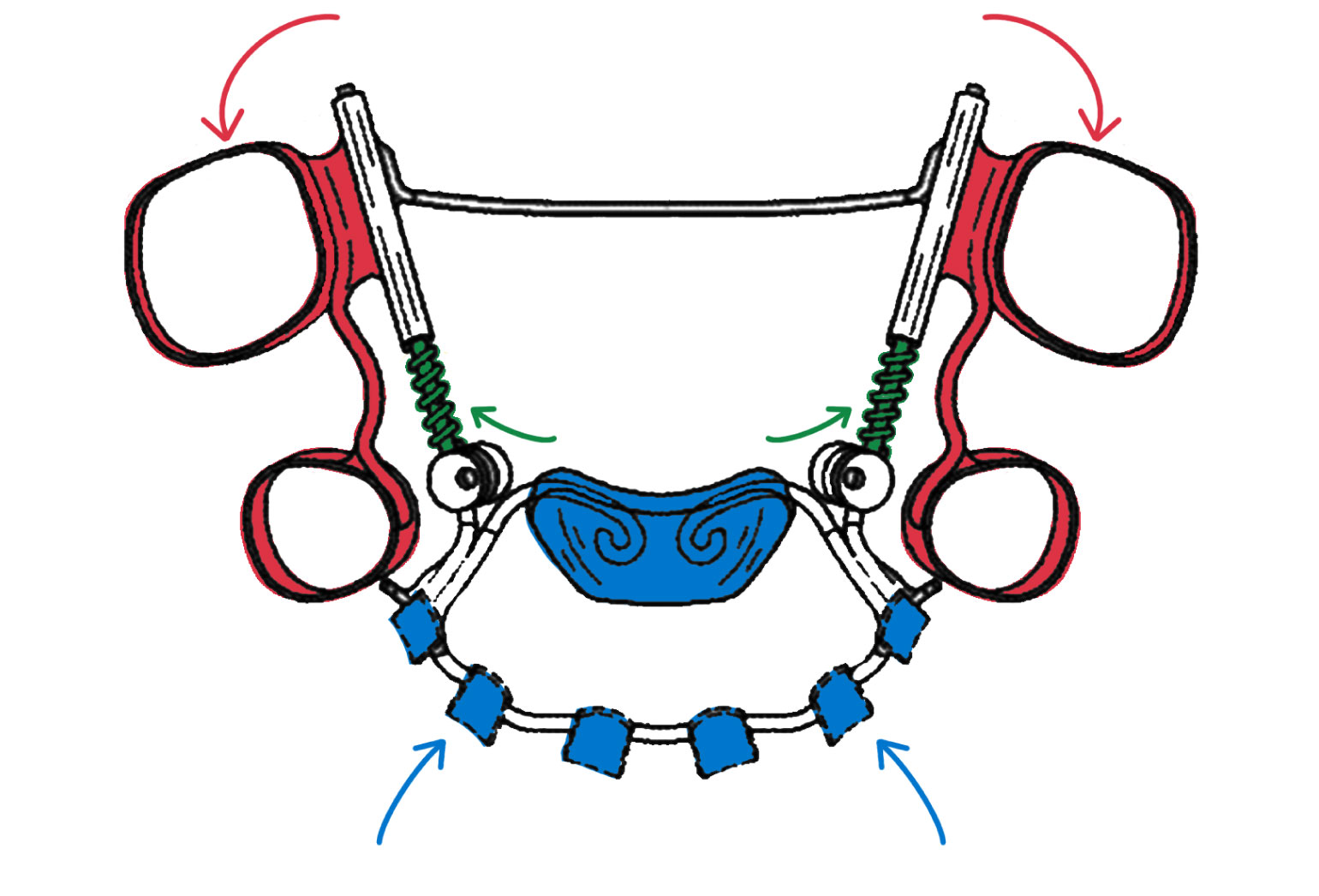molar bands secure the agga to a patient s upper back teeth